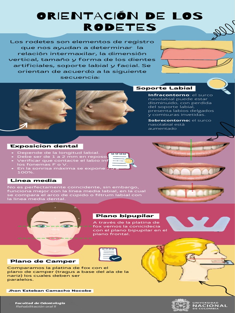 Orientacion de Los Rodetes | PDF