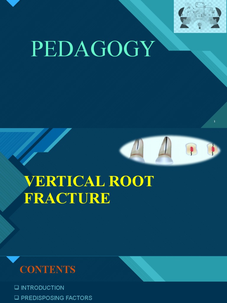 Vertical Root Fracture | PDF | Periodontology | Health Sciences