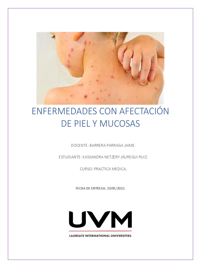 Enfermedades Con Afectación de Piel y Mucosas | PDF | Anemia | Sistema ...
