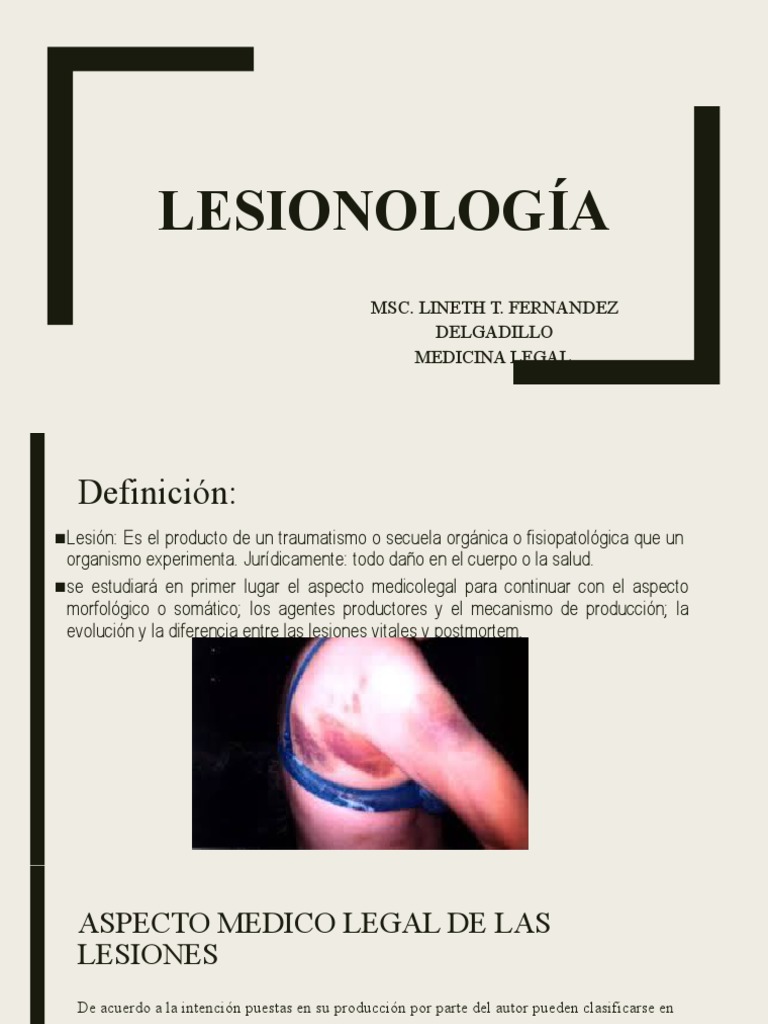 Lesionología: Msc. Lineth T. Fernandez Delgadillo Medicina Legal | PDF ...