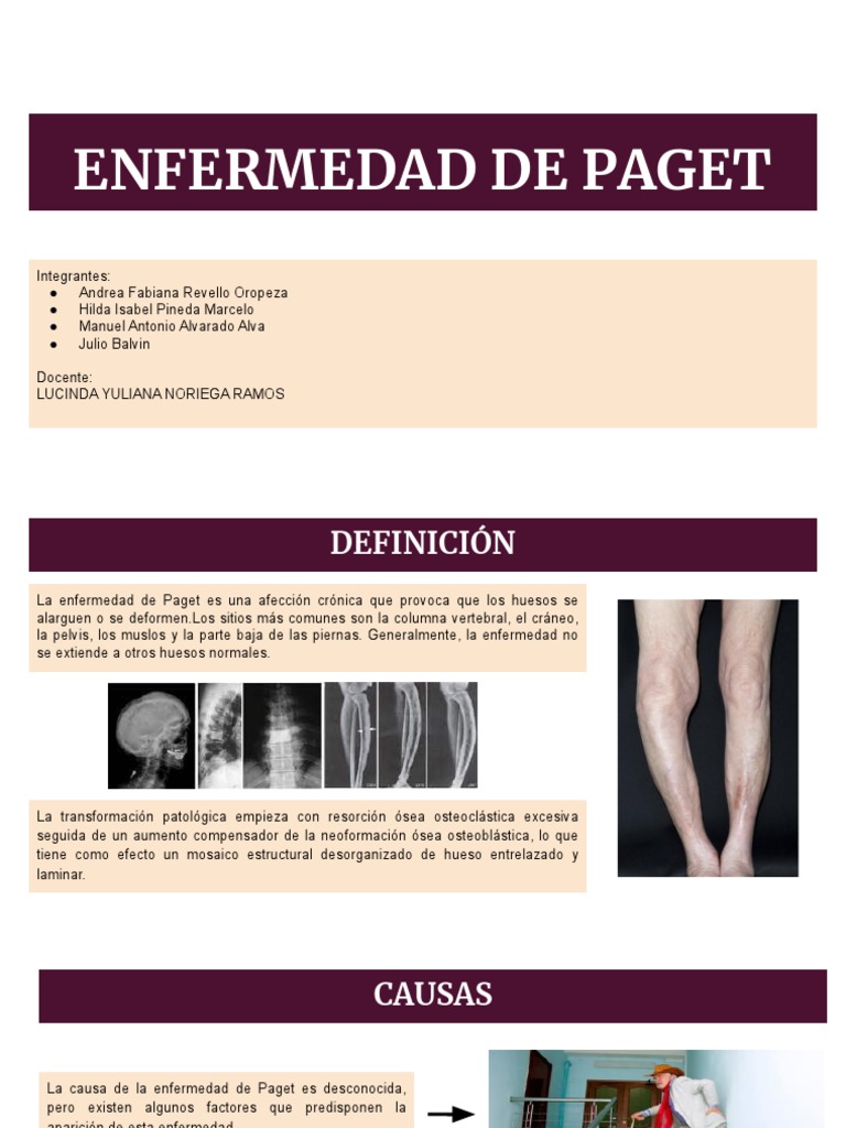Enfermedad de Paget | PDF | Hueso | Medicina CLINICA