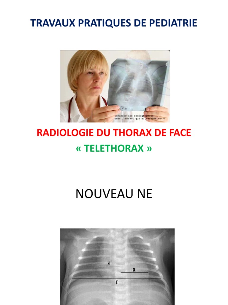 TD Le Thorax & Traces Ecg Infantile | PDF | Poumon | Thorax
