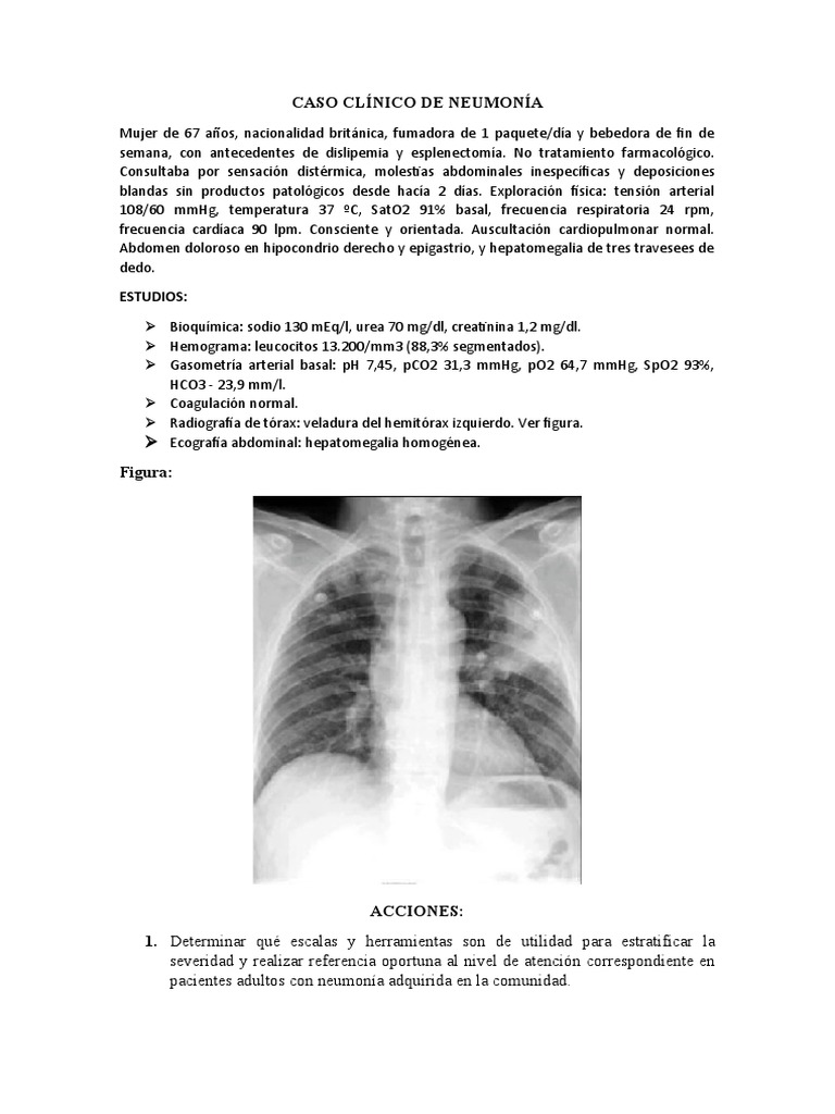CASO_CLÍNICO_DE_NEUMONÍA | PDF