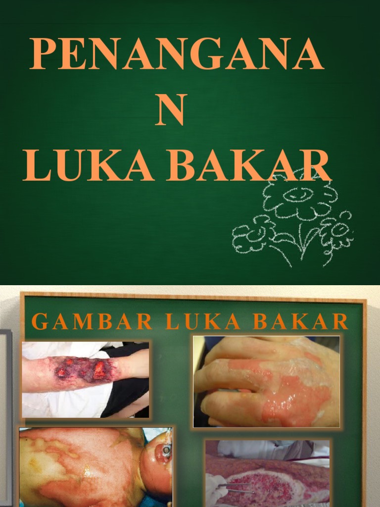 Topik 7 Penanganan Luka Bakar | PDF