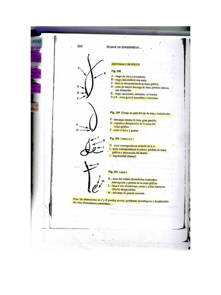 Trazos y Rasgos Del Cancer y Sida (Grafocinetica) | PDF