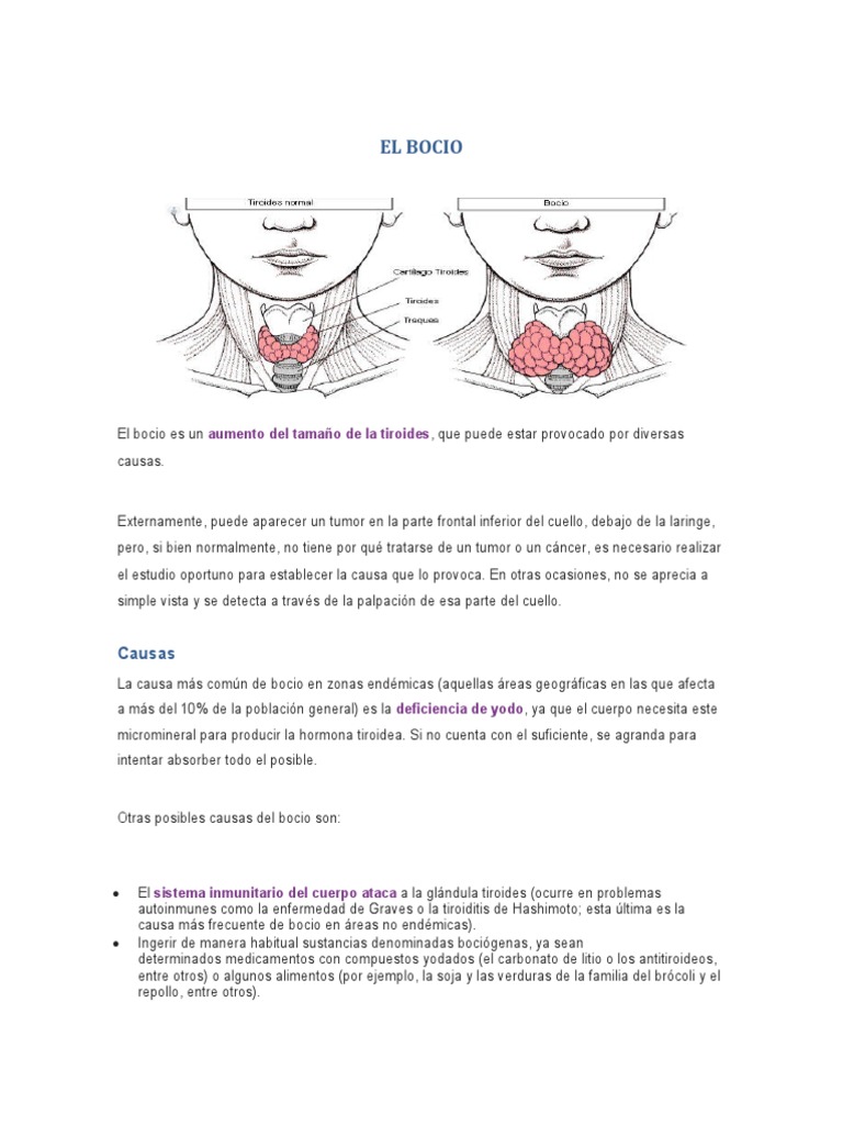 El Bocio: Causas | PDF | Tiroides | Hipertiroidismo