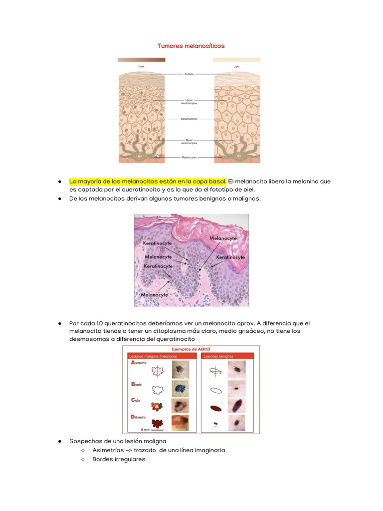 Tumores Melanocíticos | PDF | Melanoma | Piel