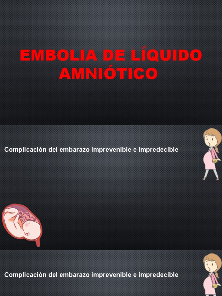 Embolia Amniótica: Riesgos y Causas | PDF