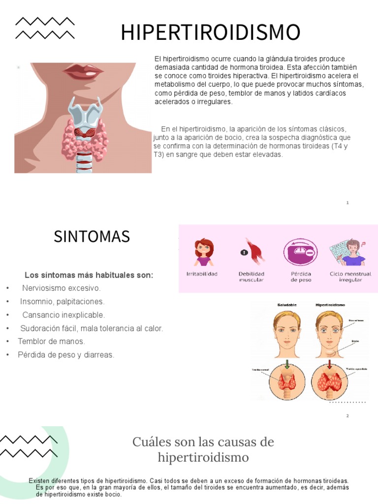 HIPERTIROIDISMO | PDF | Hipertiroidismo | Tiroides