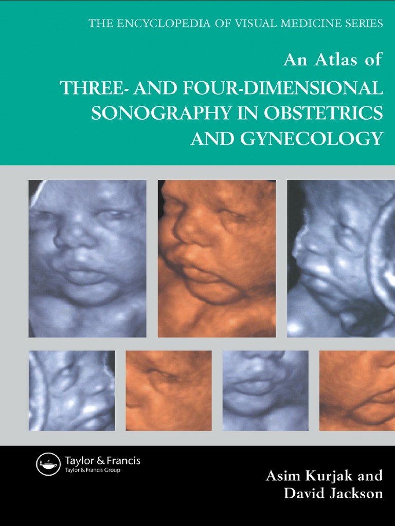 An Atlas of Three - and Four-Dimensional Sonography in Obstetrics and Gynecology by Kurjak, Asim ...