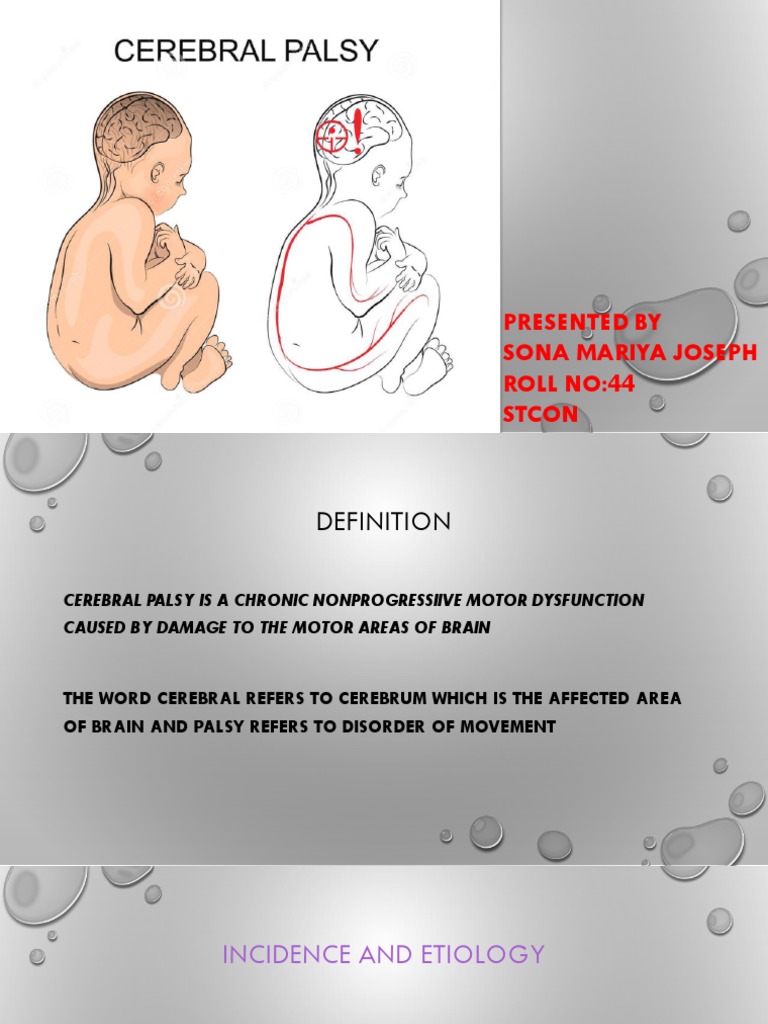 cerebral palsy paediatrics | PDF | Cerebral Palsy | Medical Specialties