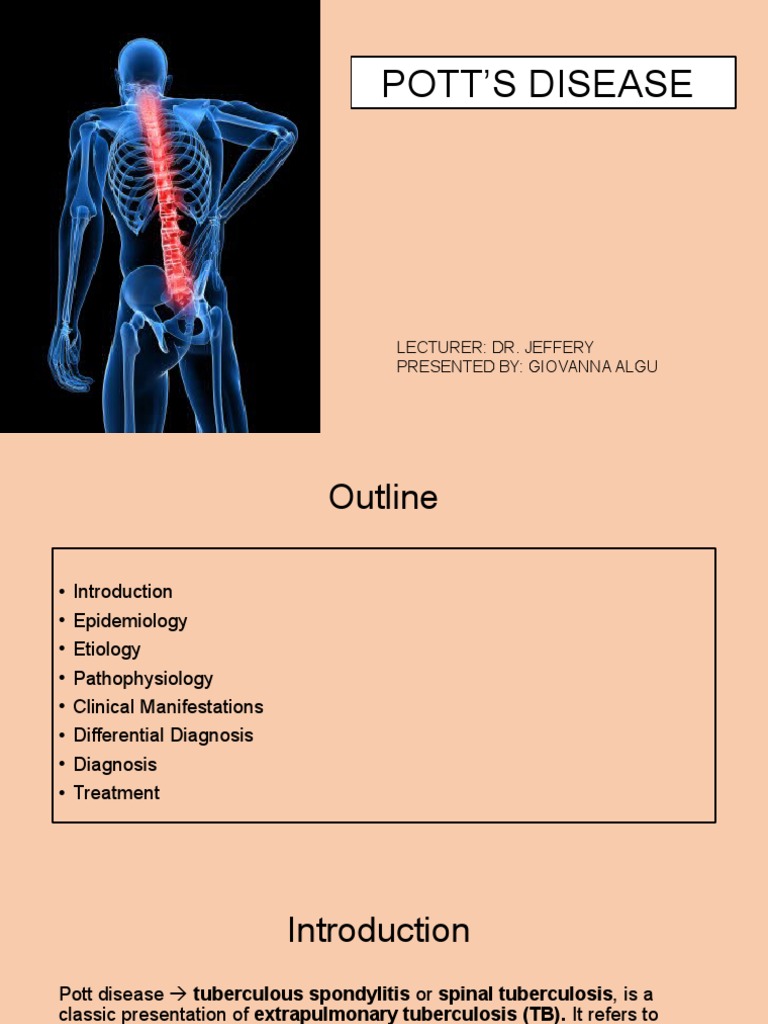 Pott Disease | PDF | Tuberculosis | Vertebral Column