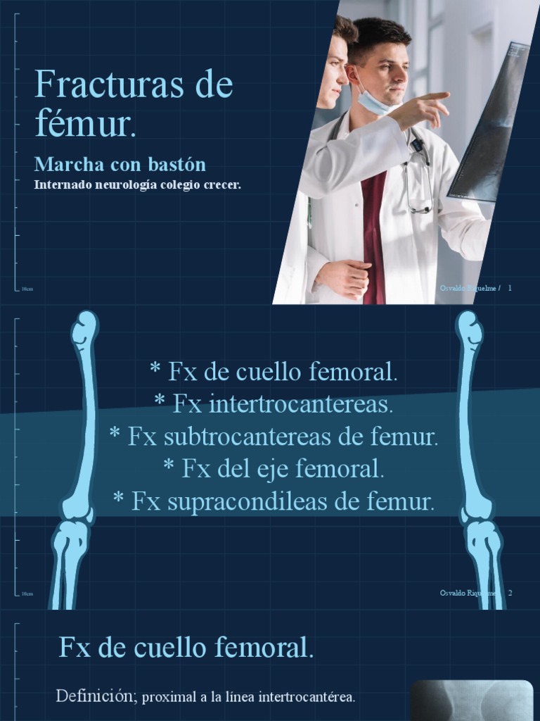 Fracturas y Marcha Con Baston. | PDF | Rodilla | Sistema musculoesquelético