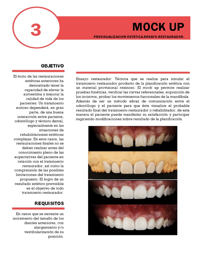 Mockup Dental: Guía y Técnicas | PDF | Odontología