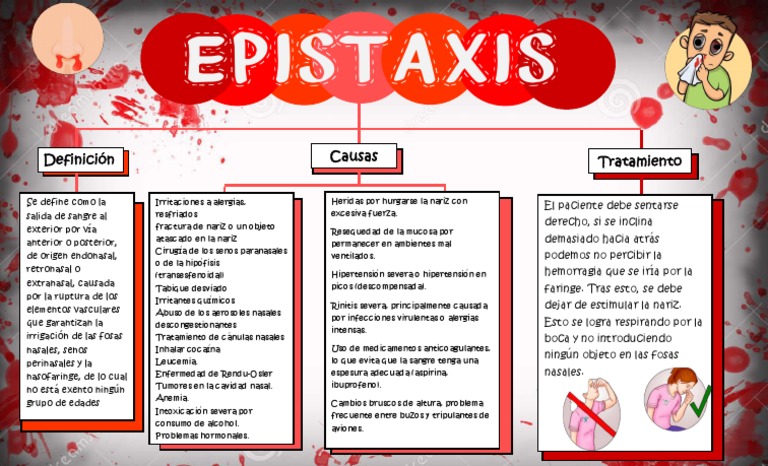 Causas y tratamiento de la epistaxis | PDF | Medicina CLINICA ...