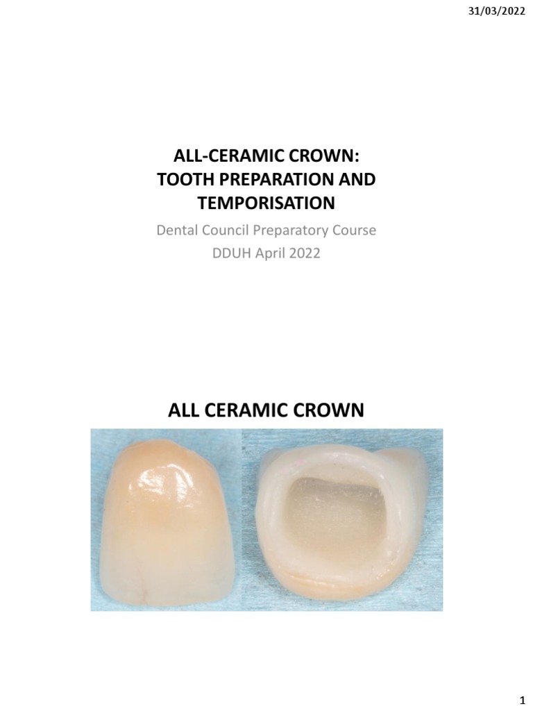 All-Ceramic Crown Preparation Guide | PDF | Polymerization | Poly ...