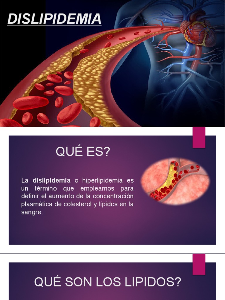 DISLIPIDEMIA VFinal | PDF | Colesterol | Lípido