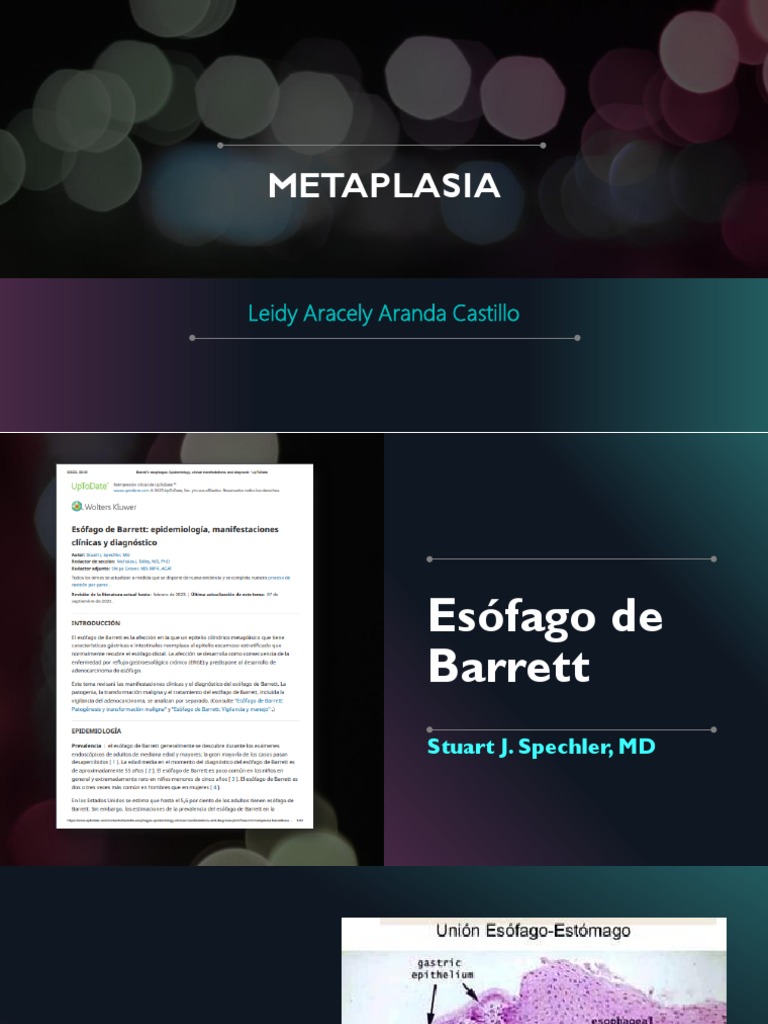 Metaplasia y Esófago de Barrett | PDF