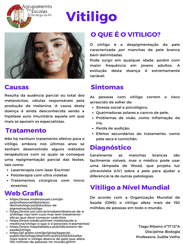 Vitiligo | PDF | Ultravioleta | Ciências da Saúde