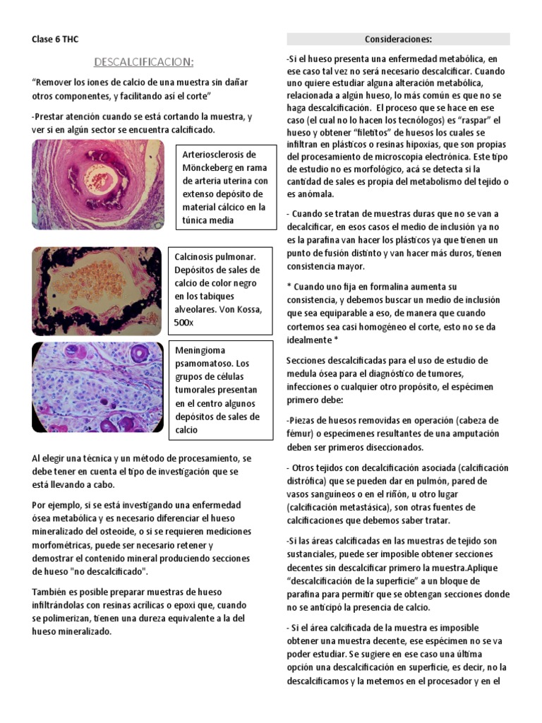 Descalcificacion:: Clase 6 THC | PDF | Ácido etilendiaminotetraacético | Calcio