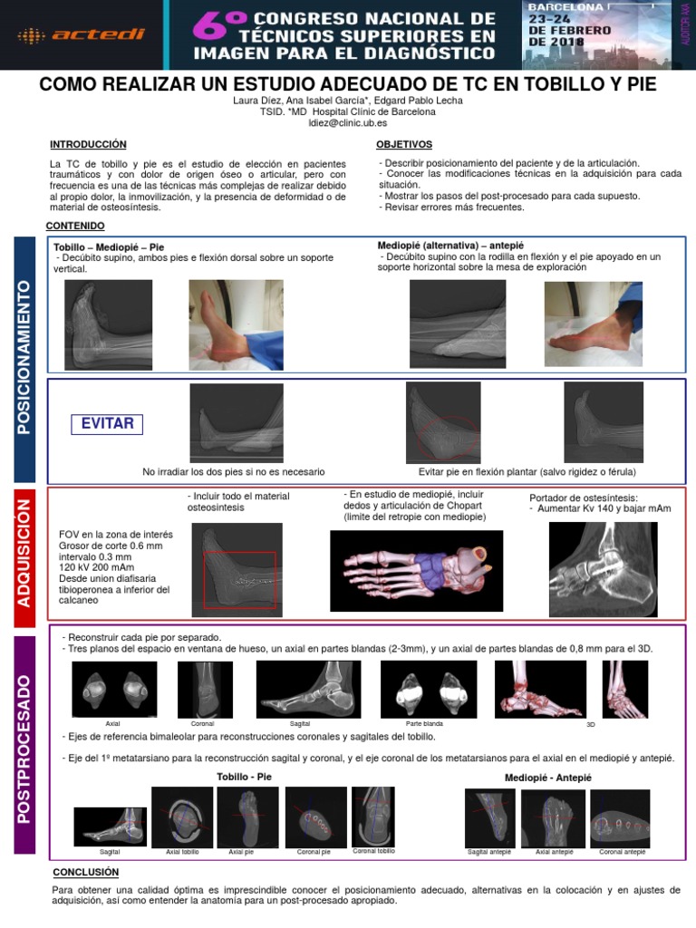 Cómo realizar un estudio adecuado de TC en tobillo y pie: posicionamiento, adquisición y post ...