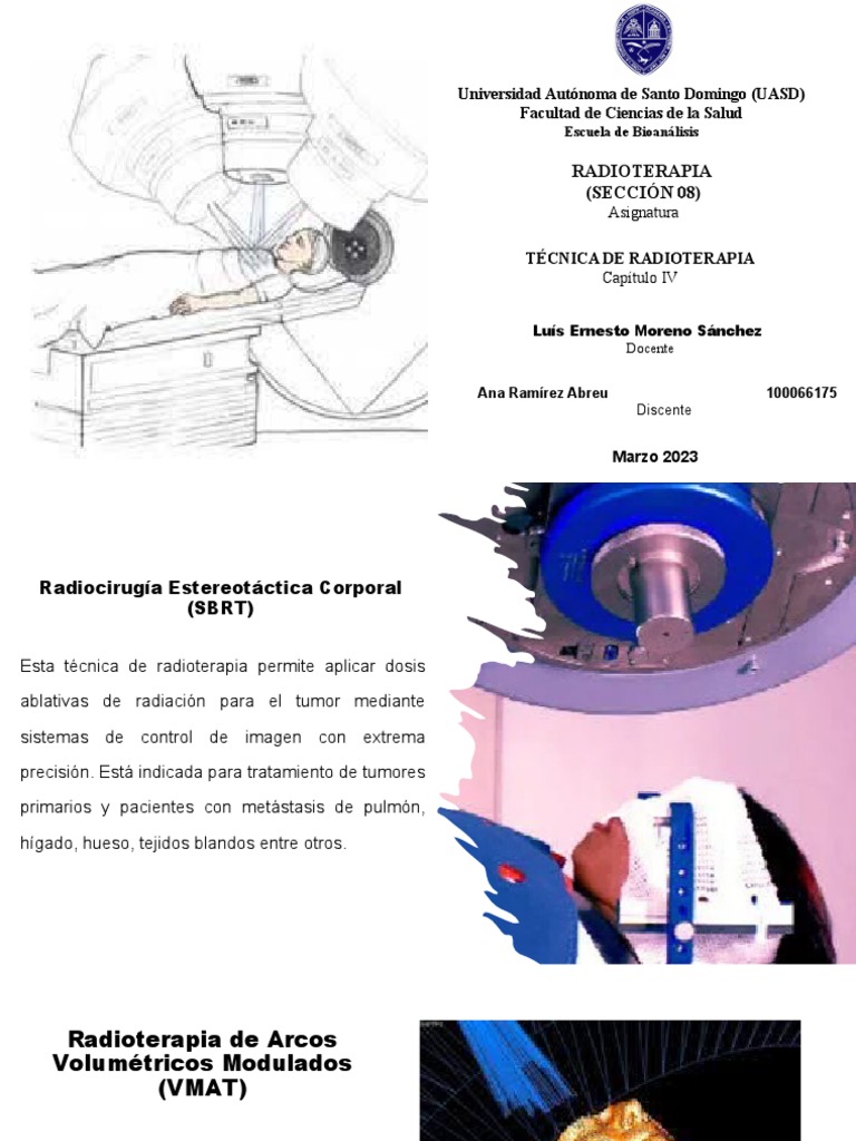 Técnicas avanzadas de radioterapia: radiocirugía estereotáctica, radioterapia de arcos ...