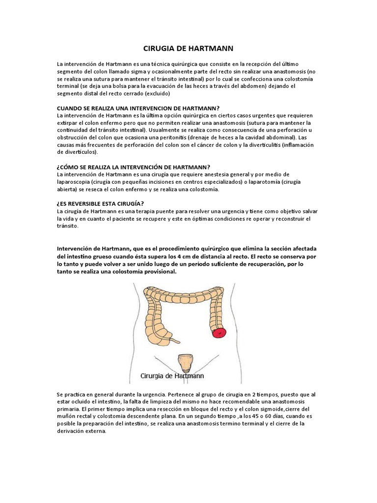 Cirugía de Hartmann: Técnica y Procedimiento | PDF | Cáncer colonrectal ...