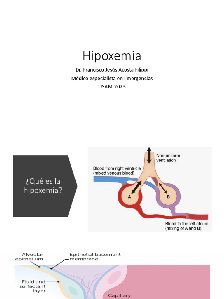 Hipoxemia | PDF