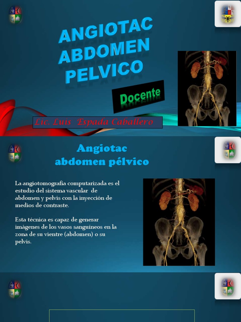 Angiotac Abdominal Pelvico | PDF | Trombo | Sangre