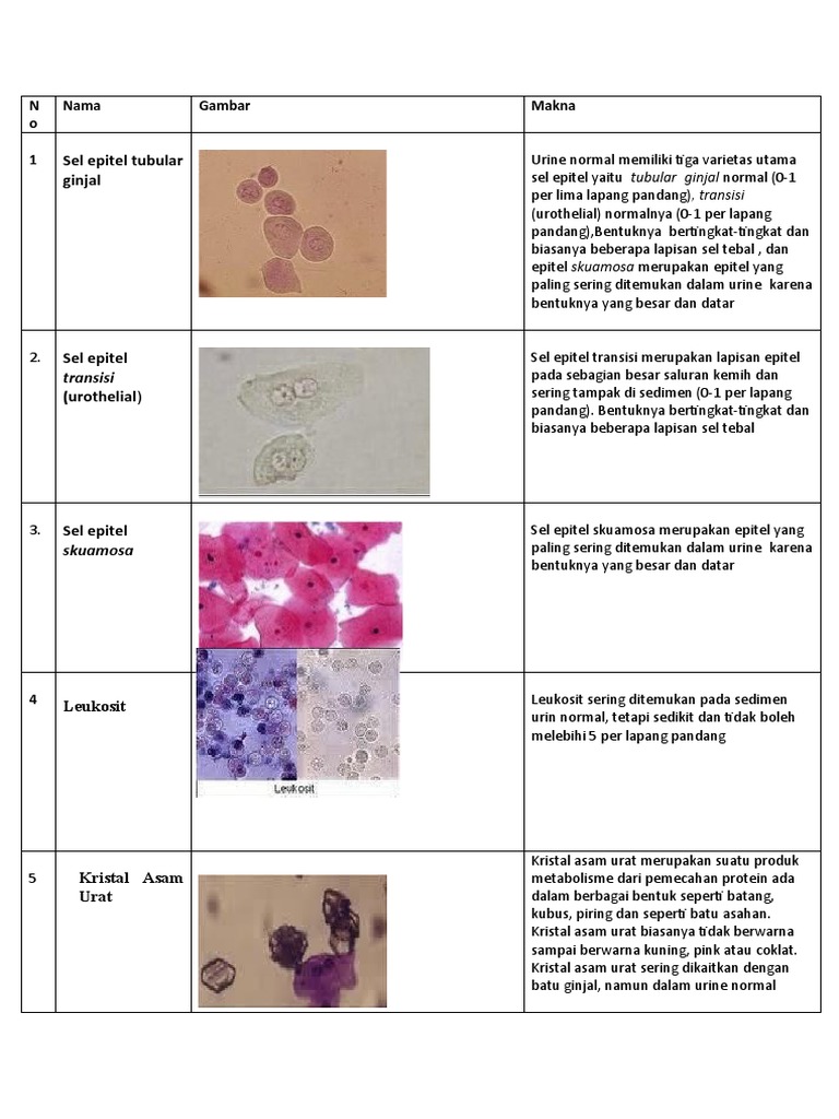 Sel Epitel Tubular Ginjal: Transisi | PDF