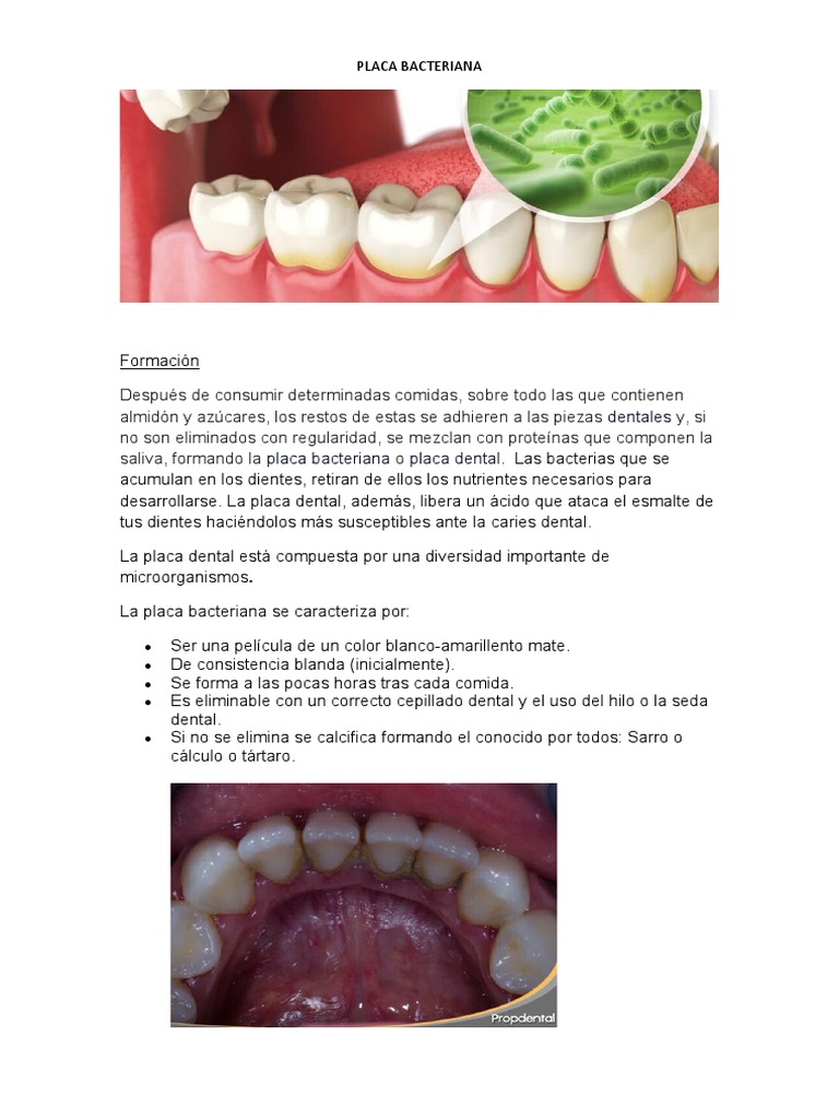 Placa Bacteriana | PDF | Higiene oral | Boca