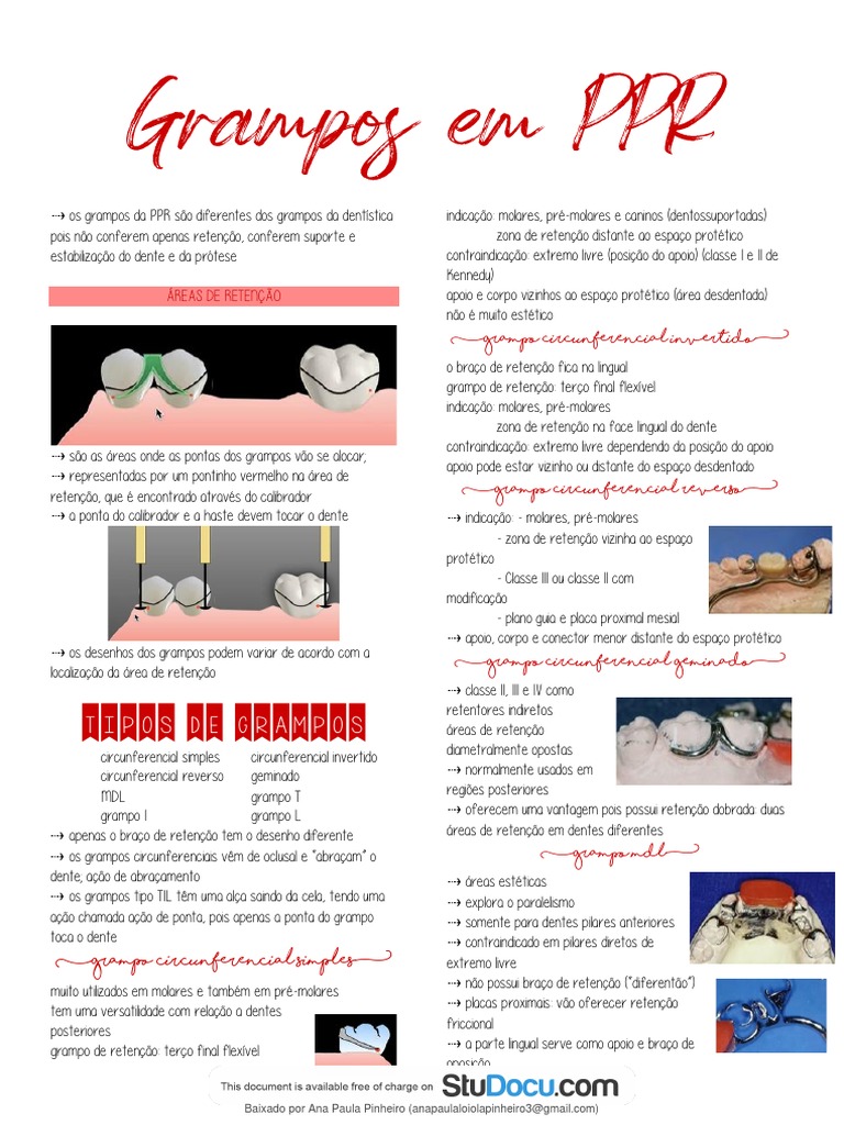 Tipos de Grampos para PPR | PDF | Dente