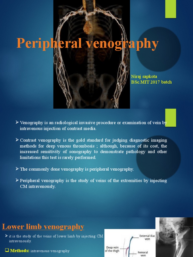 Peripheral Venography: Niraj Sapkota BSC - Mit 2017 Batch | PDF ...