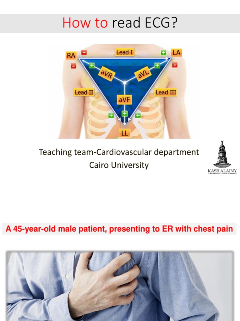 How To: Read ECG? | PDF | Electrocardiography | Internal Medicine