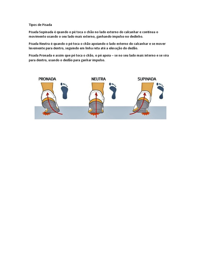 Tipos de Pisadas: Supinada, Neutra e Pronada | PDF