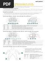 12 Lead ECG Placement Guide | PDF | Cardiology