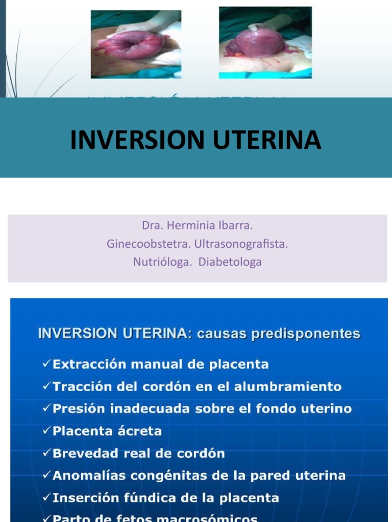 INVERSION UTERINA Unan | PDF
