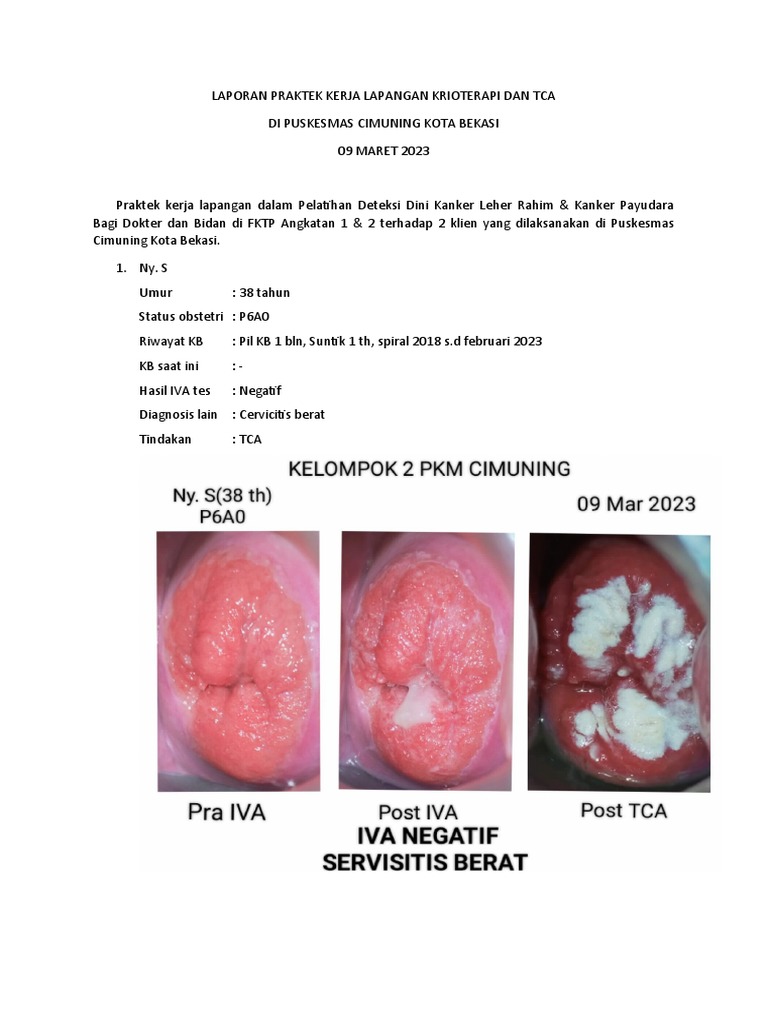 Laporan Praktek Kerja Lapangan Krioterapi Dan Tca | PDF
