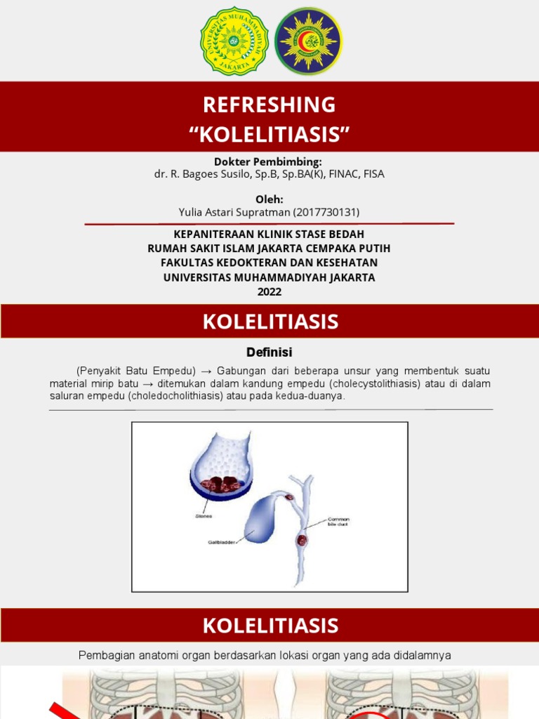 Memahami Kolelitiasis: Penyakit Batu Empedu | PDF | Kesehatan Holistik