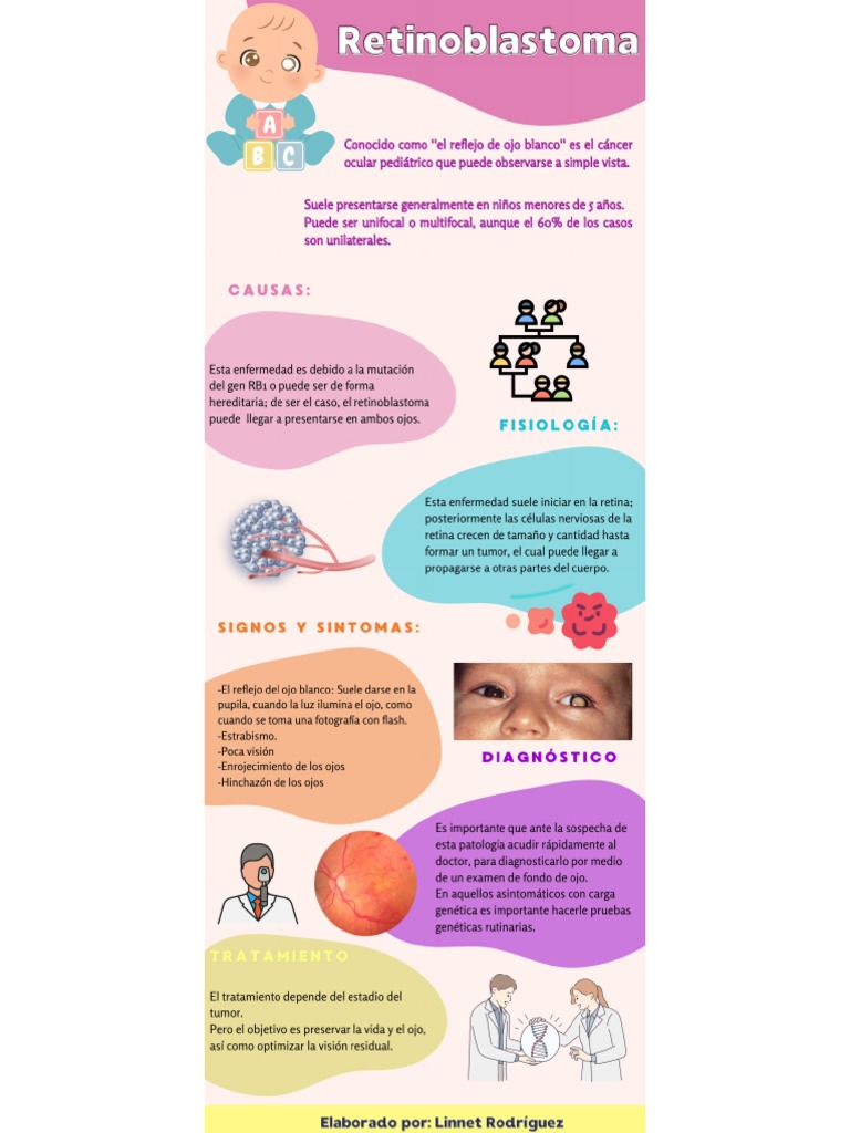 Retinoblastoma Infografía | PDF