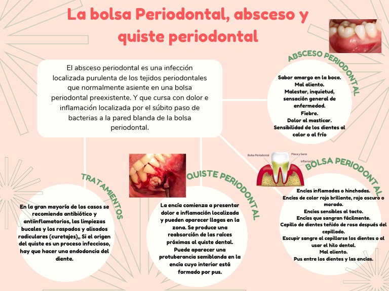 Mapa Conceptual Del Tema La Bolsa Periodontal, Absceso y Quiste ...