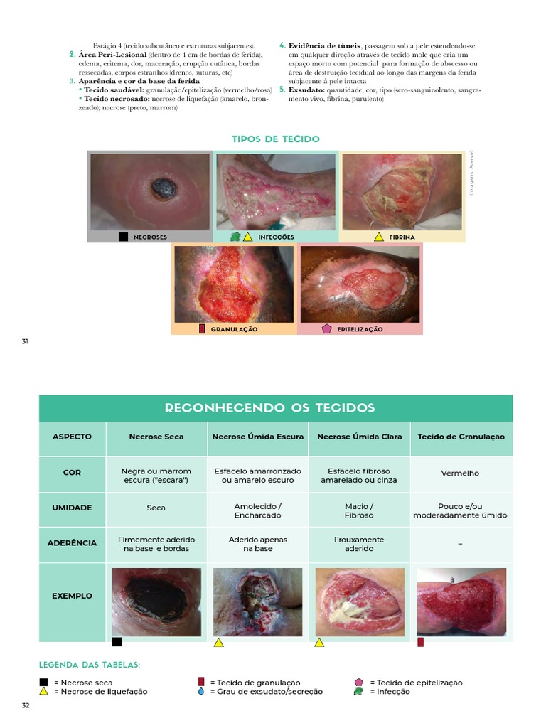 Manual Protocoloferidasmarco2021 Digital | PDF | Necrose | Doenças e ...