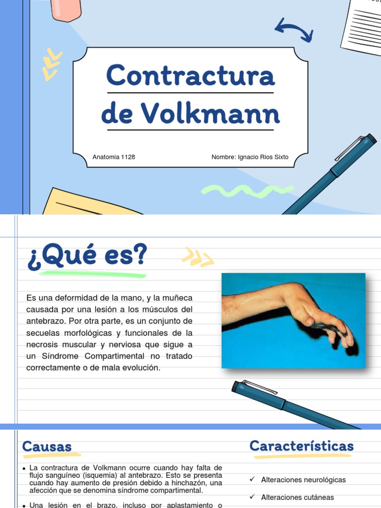Contractura de Volkmann | PDF | Mano | Enfermedades y trastornos