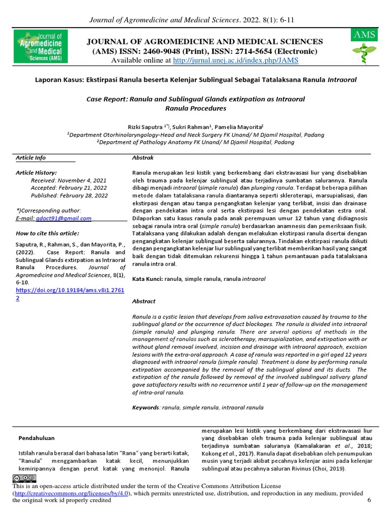Ranula and Sublingual Glands Extirpation As Intraoral Ranula Procedures ...