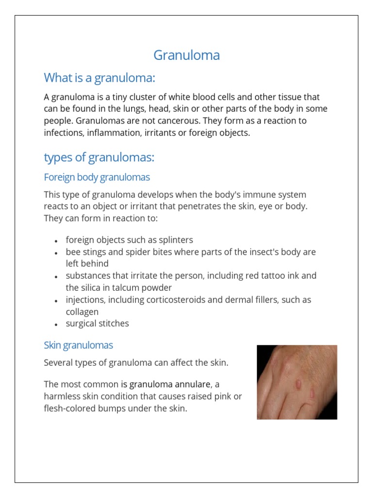Granuloma Pathology | PDF | T Helper Cell | Medical Specialties