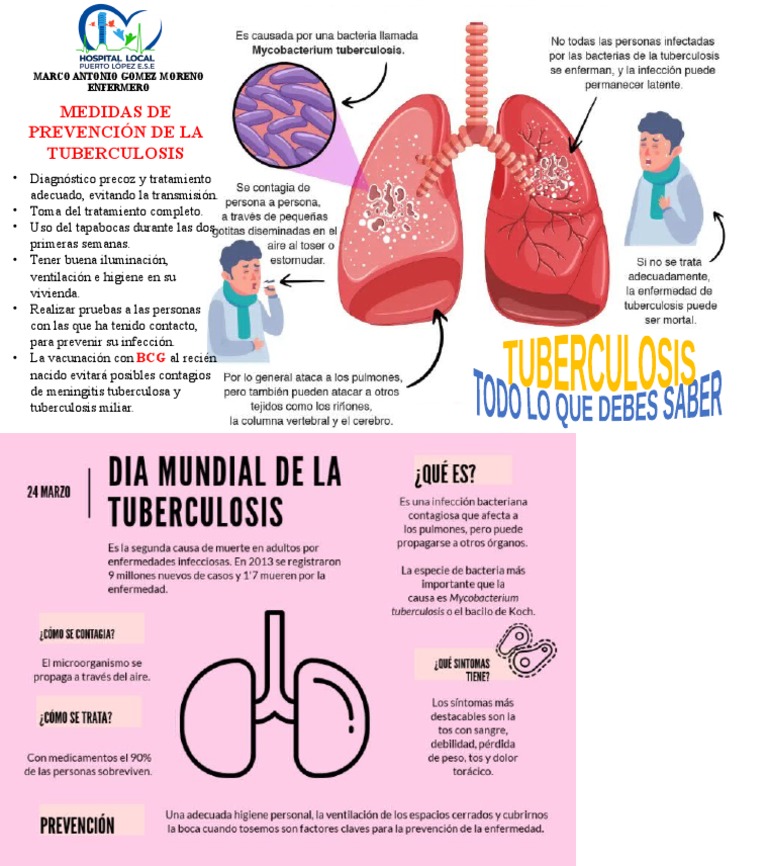 Infografía TB | PDF