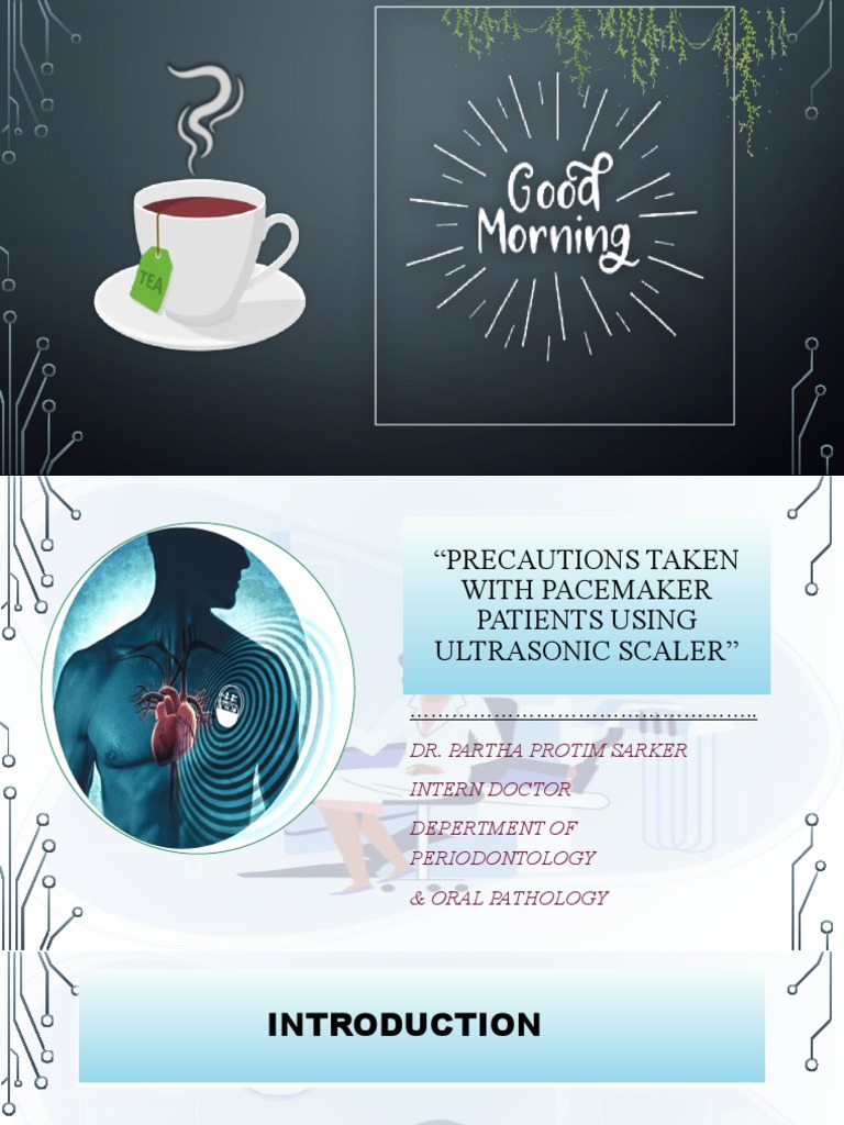 Precautions Taken With Pacemaker Patients Using Ultrasonic Scaler | PDF ...