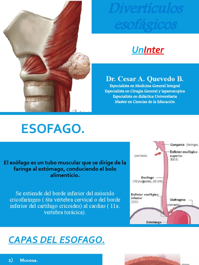 Diverticulos Esofagicos..Dr. Cesar Q. | PDF | Esófago | Estómago