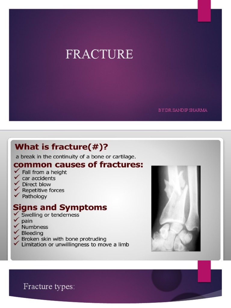 Fracture | PDF