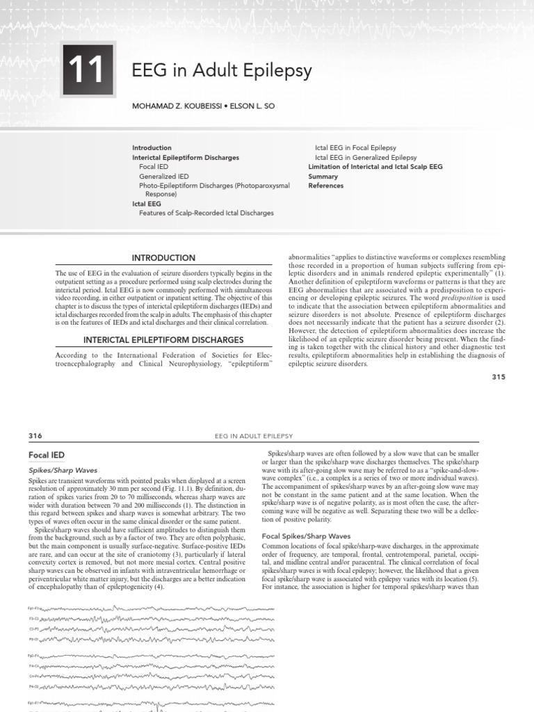 EEG in Adult Epilepsy | PDF | Electroencephalography | Epilepsy